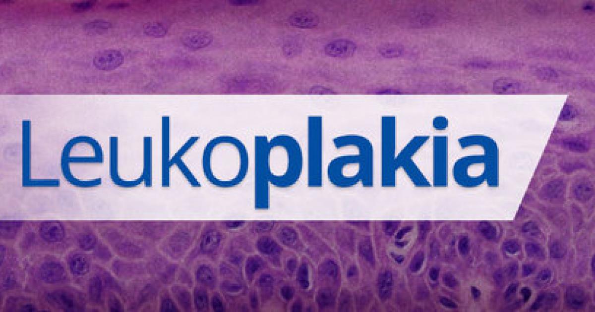 Leukoplakia - oral care, dental treatments available in Los Algodones