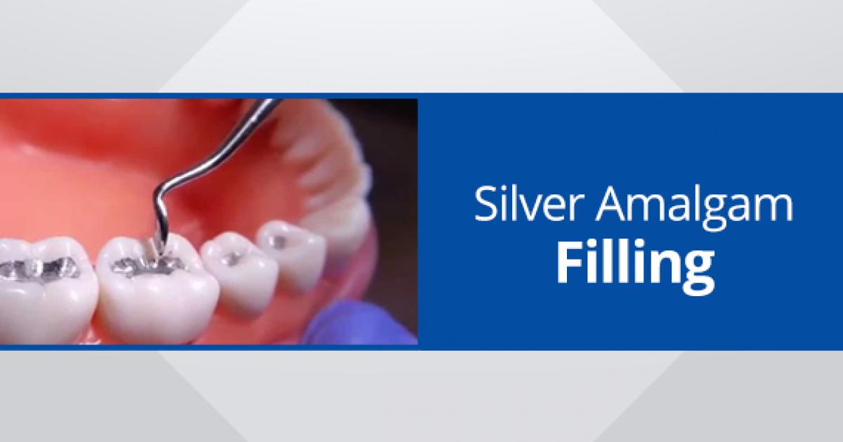Silver Amalgam Fillings