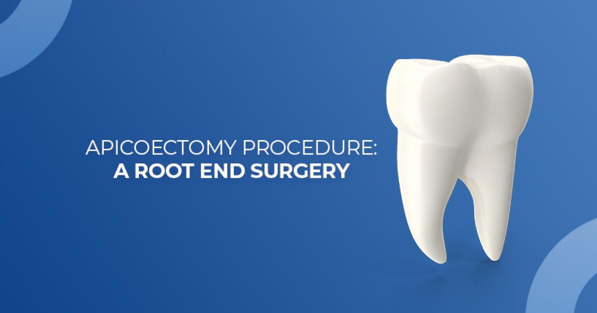 Apicoectomy Procedure: A Root End Surgery