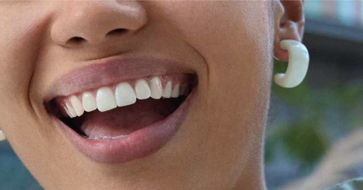 The Art of Smile Design: Your Path to a Perfect Smile